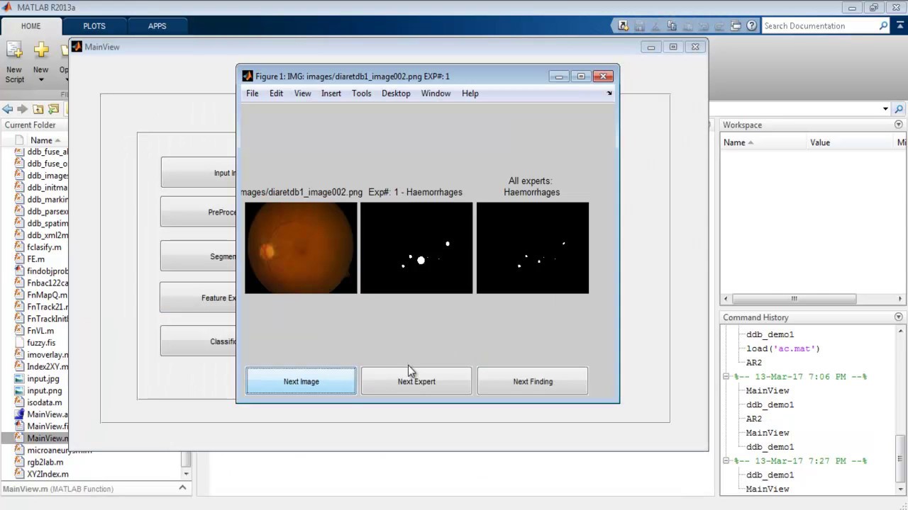 Diabetic Retinopathy Detection & Classification Matlab Code Projects ... Diabetic Retinopathy Detection & Classification Matlab Code Projects ...